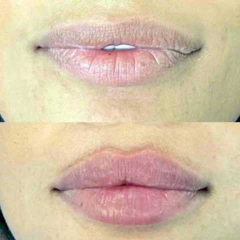 Russian Lips - Medecine Nutrition et Danse